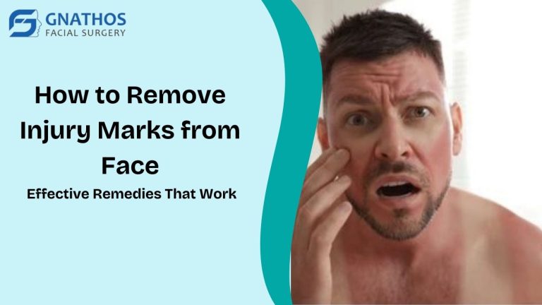 How to Remove Injury Marks from Face: Effective Remedies That Work ...